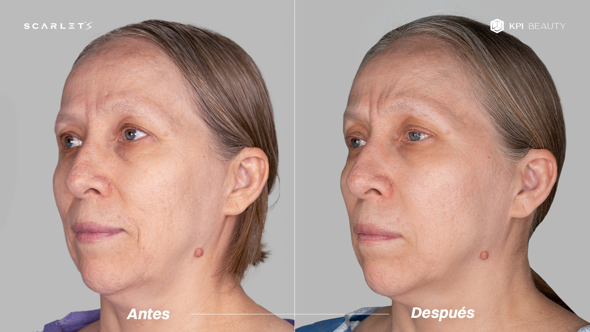 Scarlet S - KPI Beauty | Scarlet S